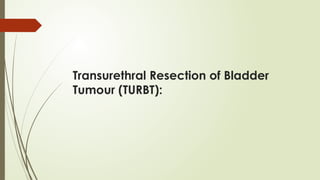 Transurethral Resection of Bladder Tumour (TURBT) and Pyeloplasty | PPTX