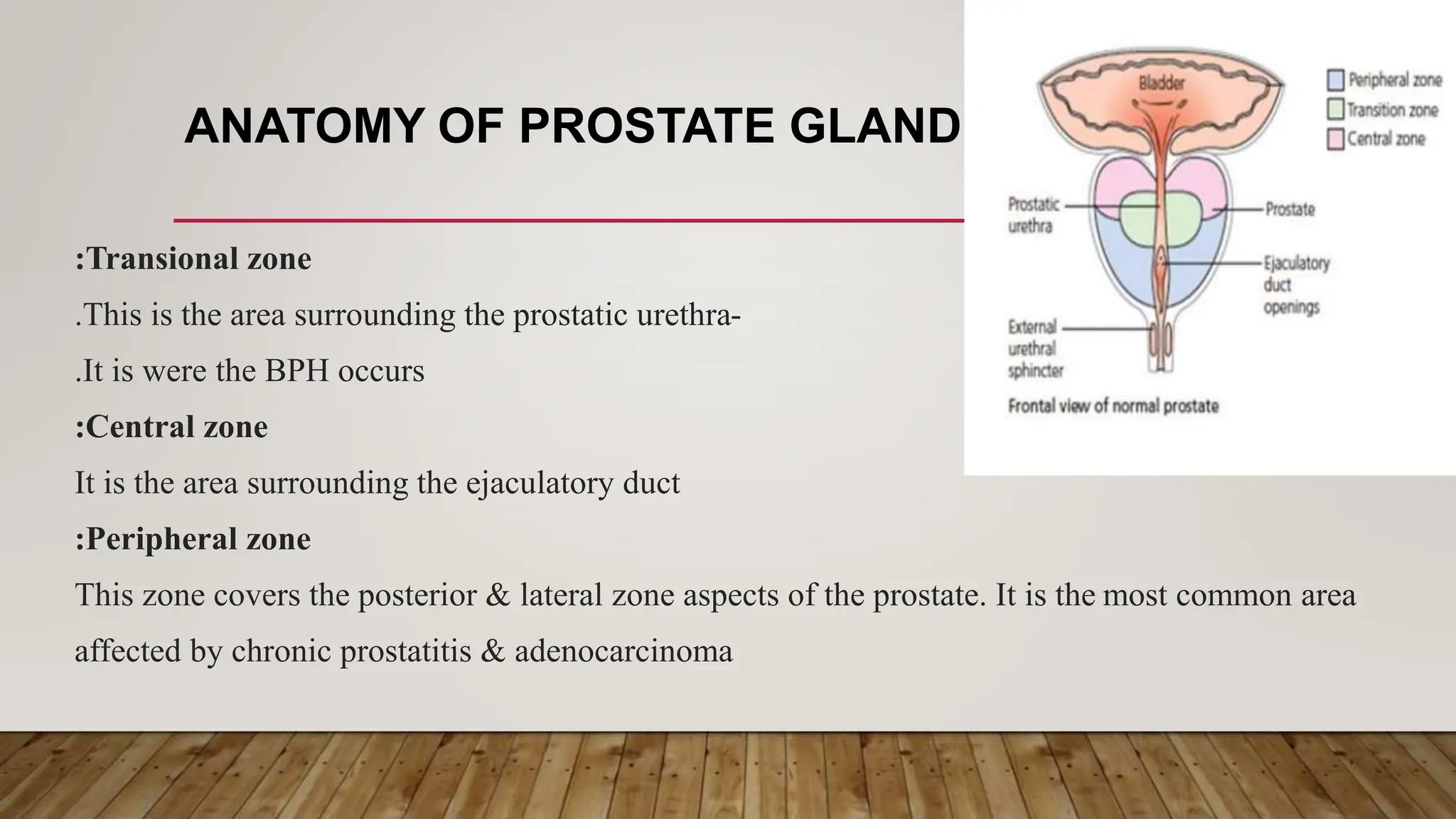 TRANSURETHRAL RESECTION OF PROSTATE.pptx