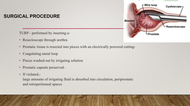 TRANSURETHRAL RESECTION OF PROSTATE.pptx