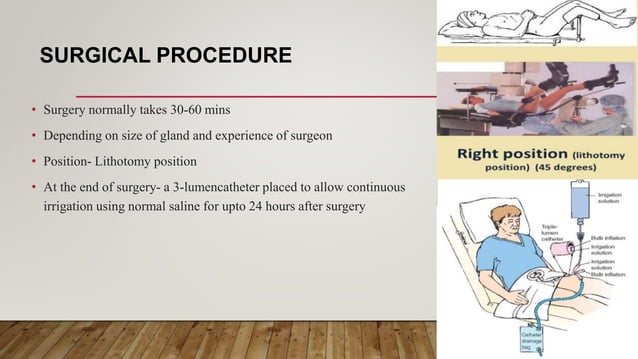 TRANSURETHRAL RESECTION OF PROSTATE.pptx