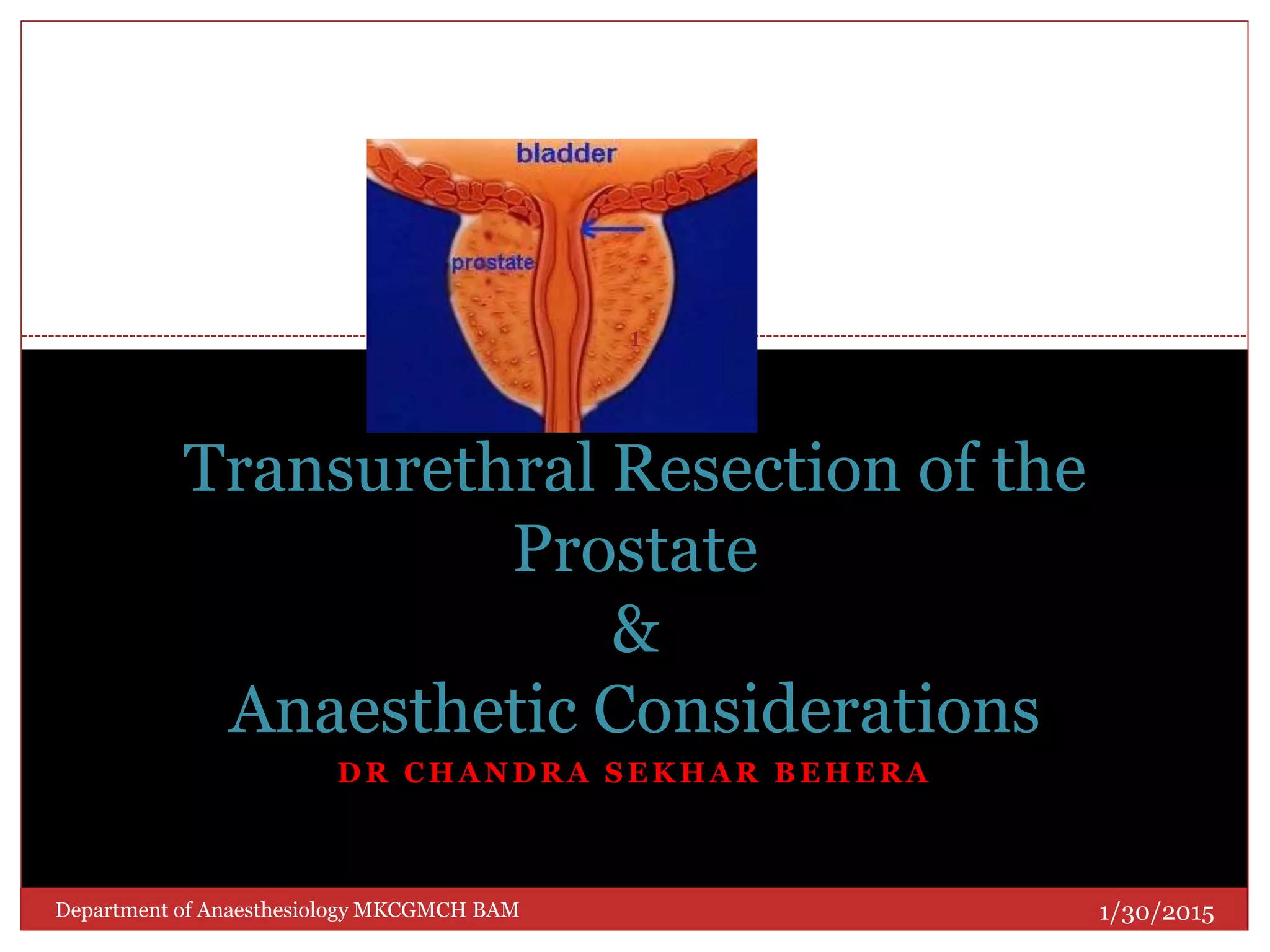 Transurethral resection of the prostate | PPTX