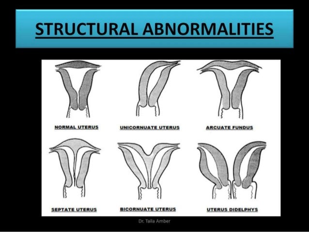 Transvaginal ultrasound presentation by Dr. Taila Amber