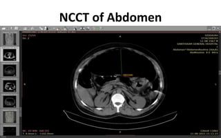Transverse colon volvulus | PPTX