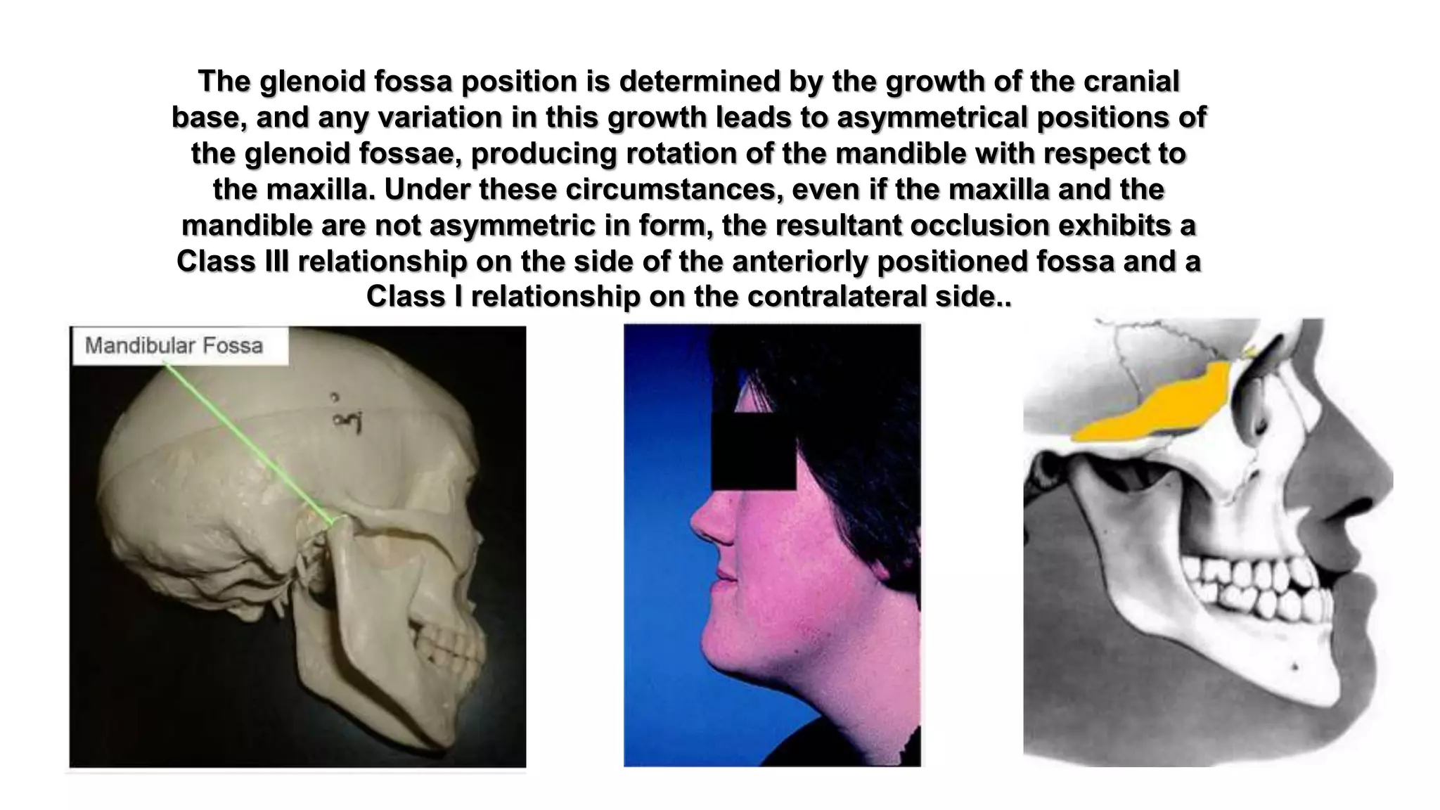 Transverse discrepancies | PPTX