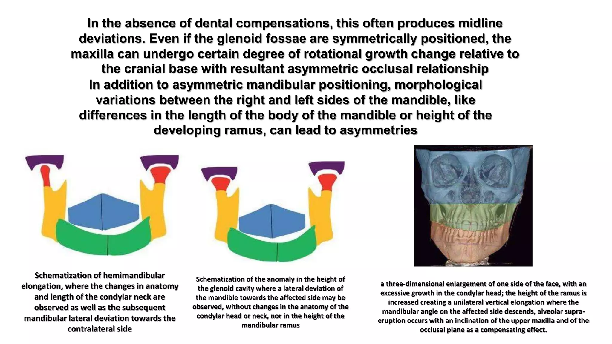 Transverse discrepancies | PPTX