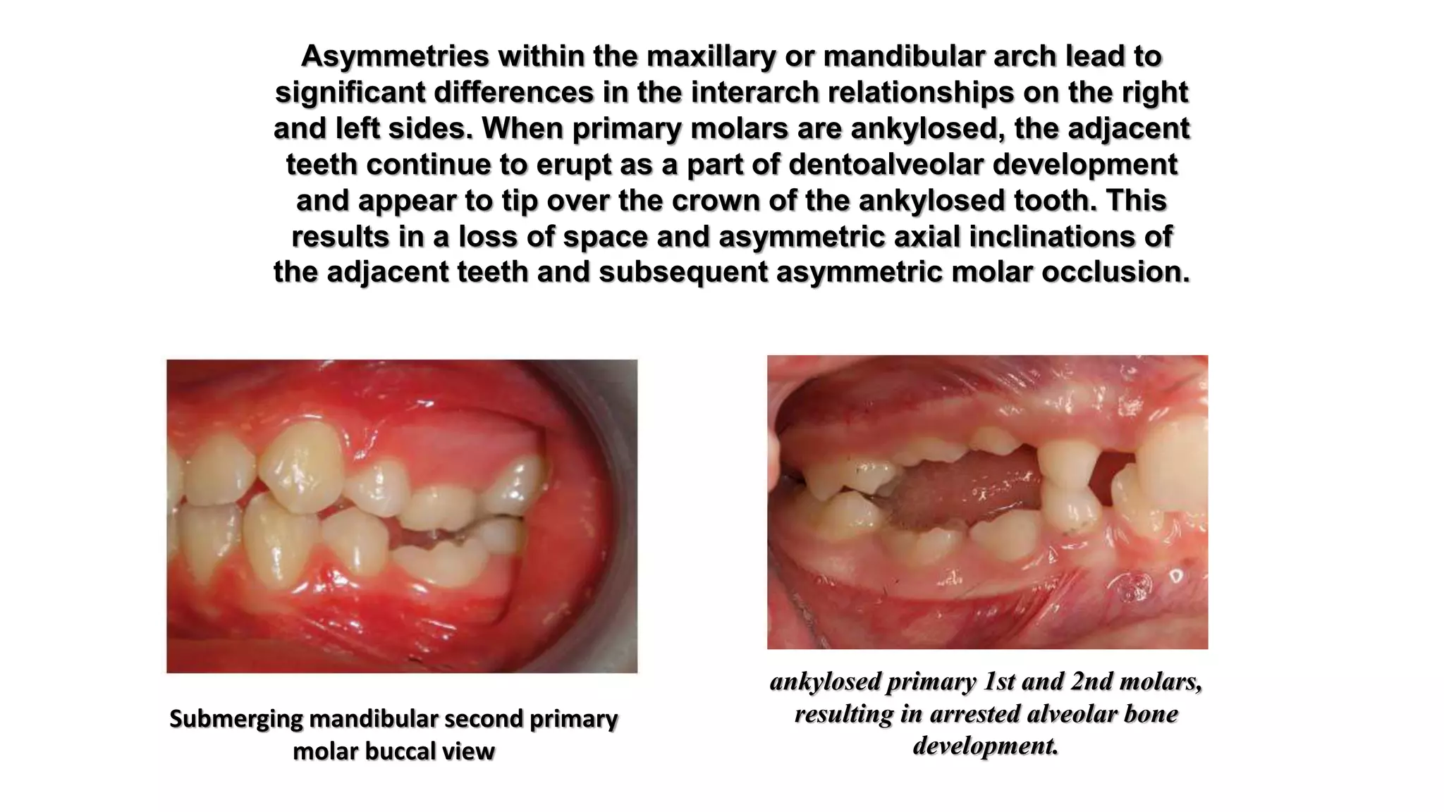 Transverse discrepancies | PPTX