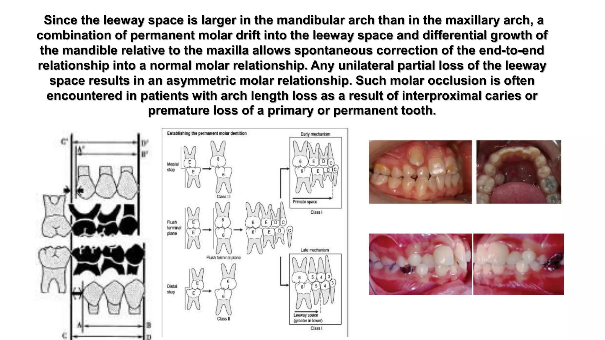 Transverse discrepancies | PPTX