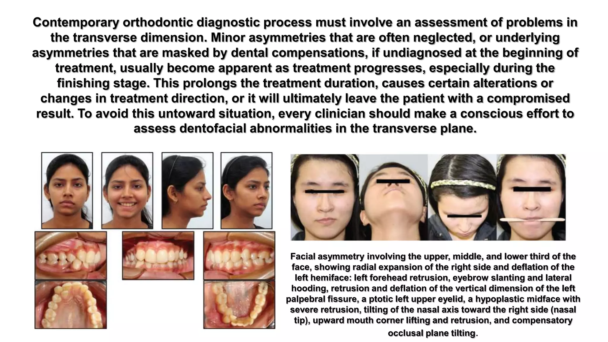 Transverse discrepancies | PPTX