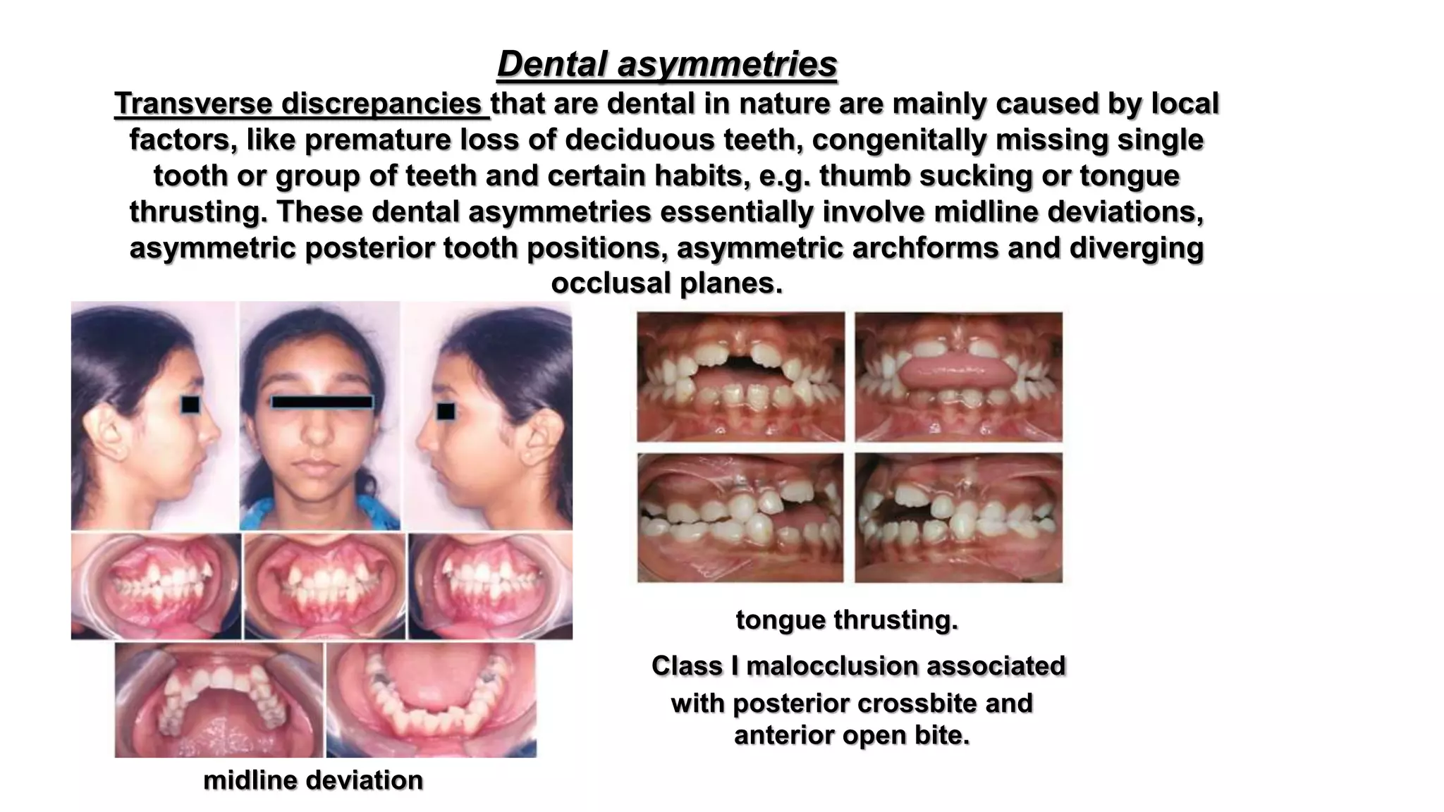Transverse discrepancies | PPTX