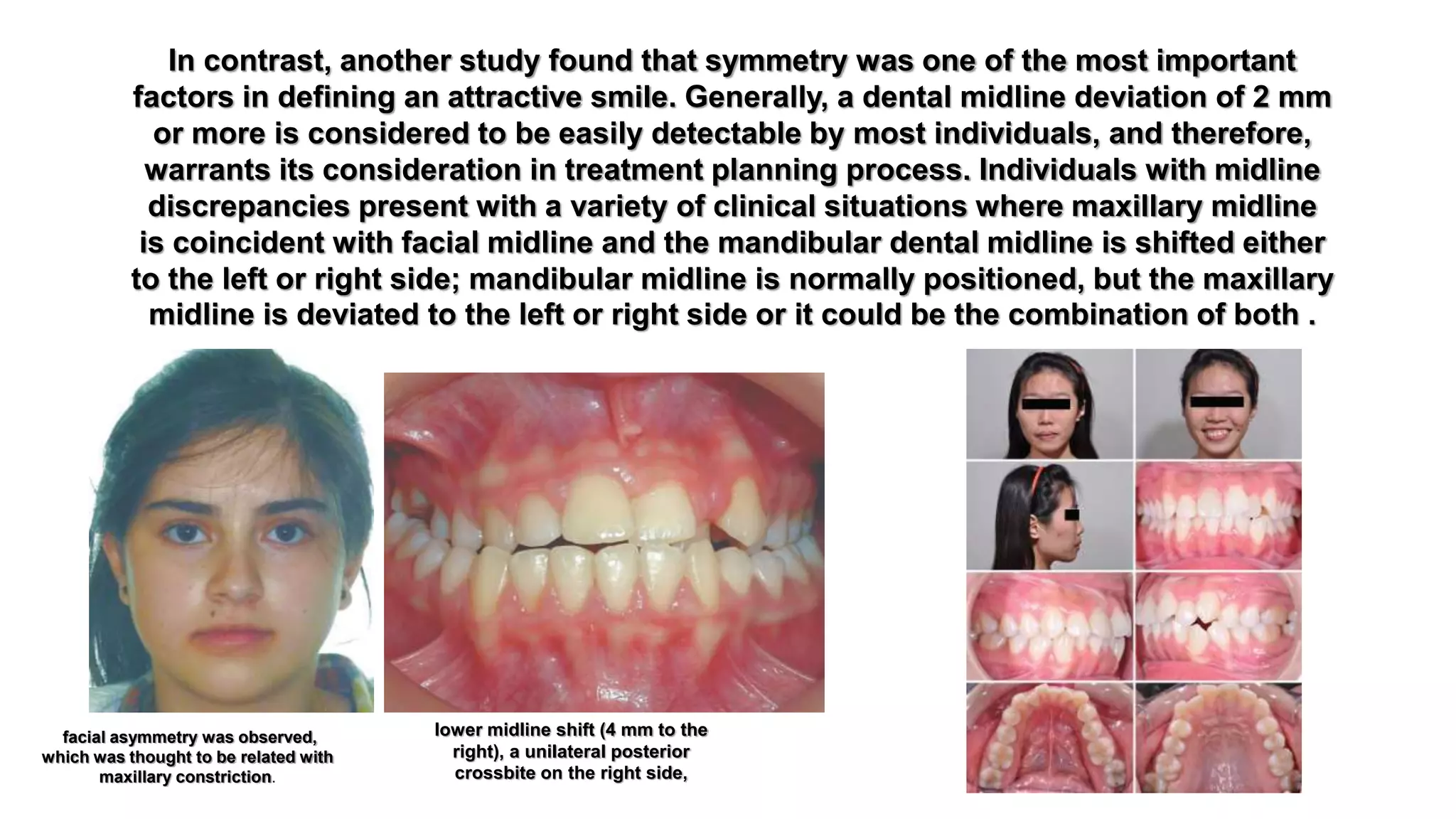 Transverse discrepancies | PPTX