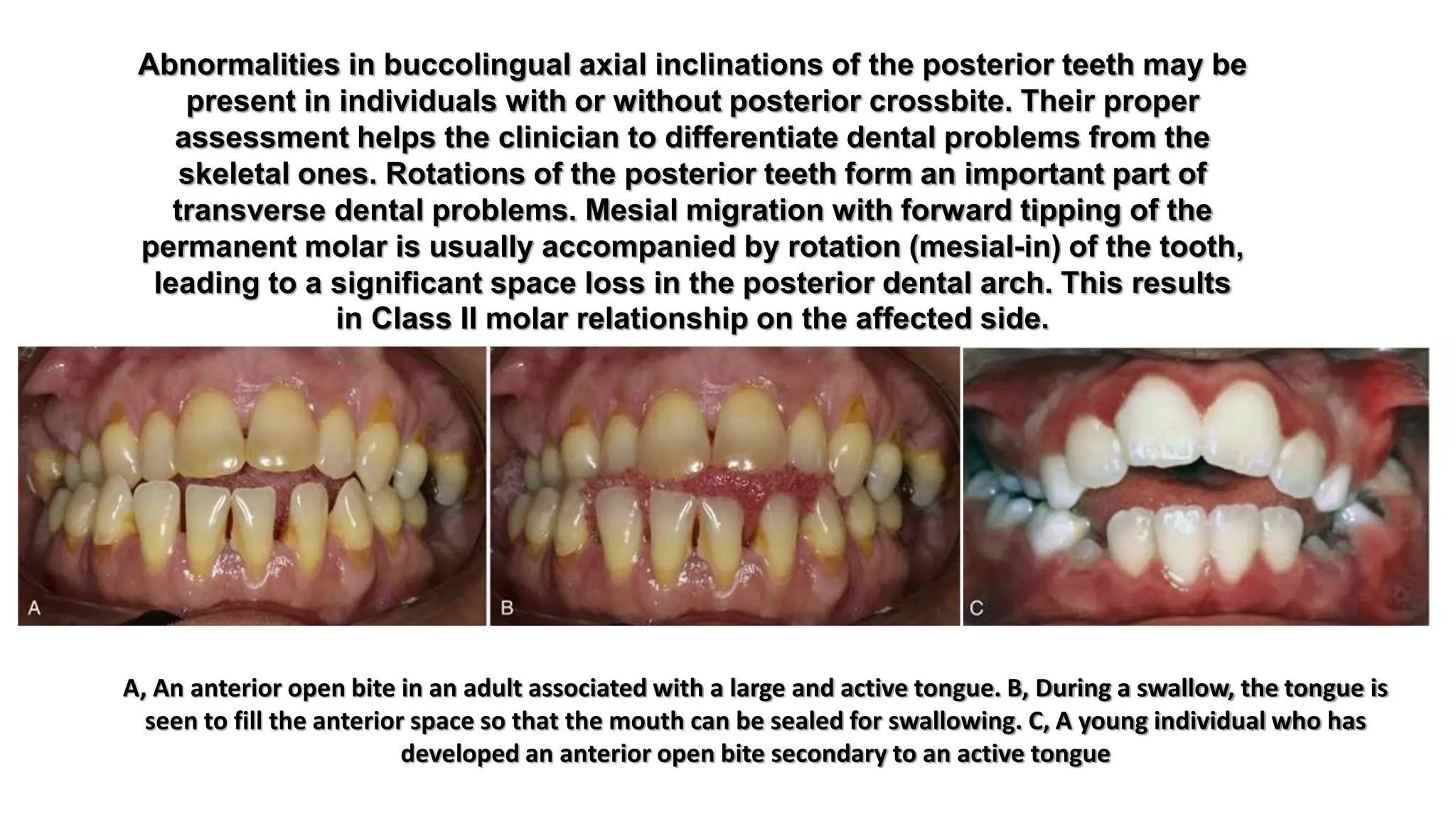 Transverse discrepancies | PPTX