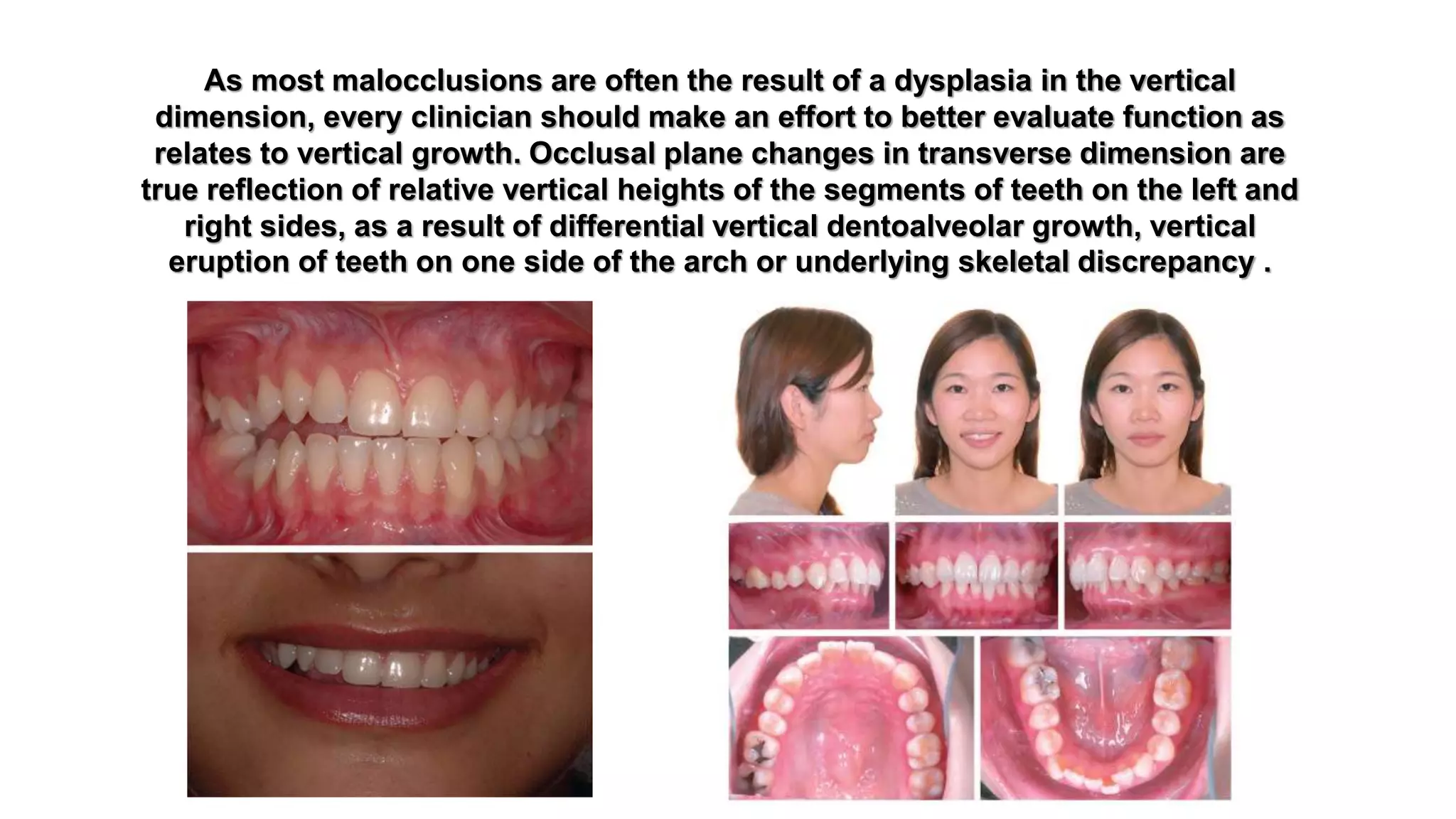Transverse discrepancies | PPTX