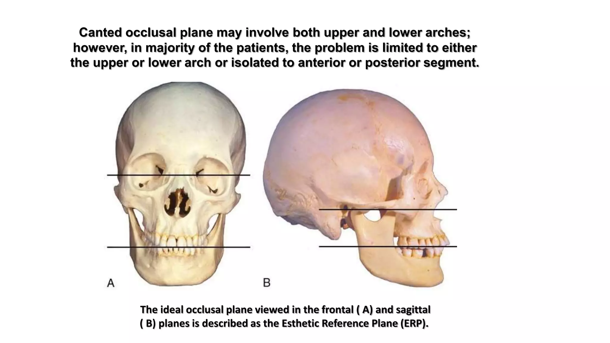 Transverse discrepancies | PPTX