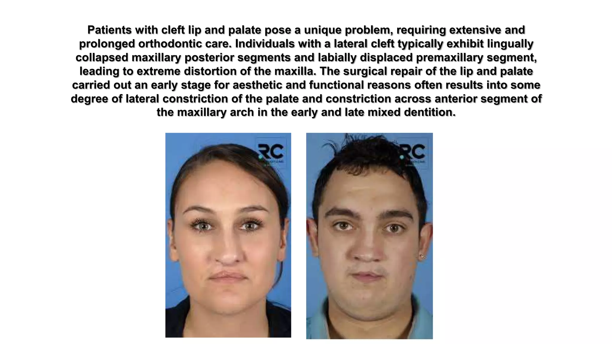 Transverse discrepancies | PPTX