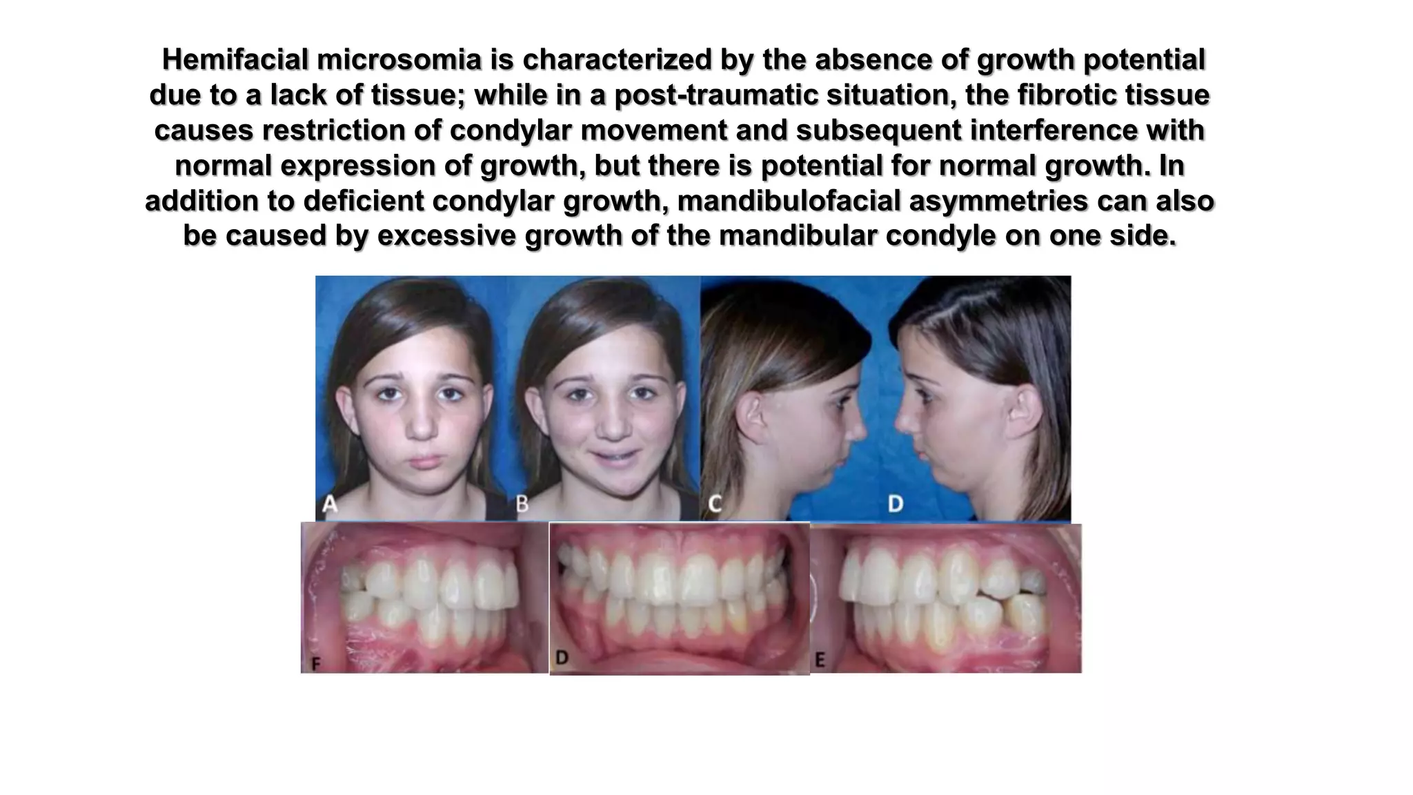 Transverse discrepancies | PPTX