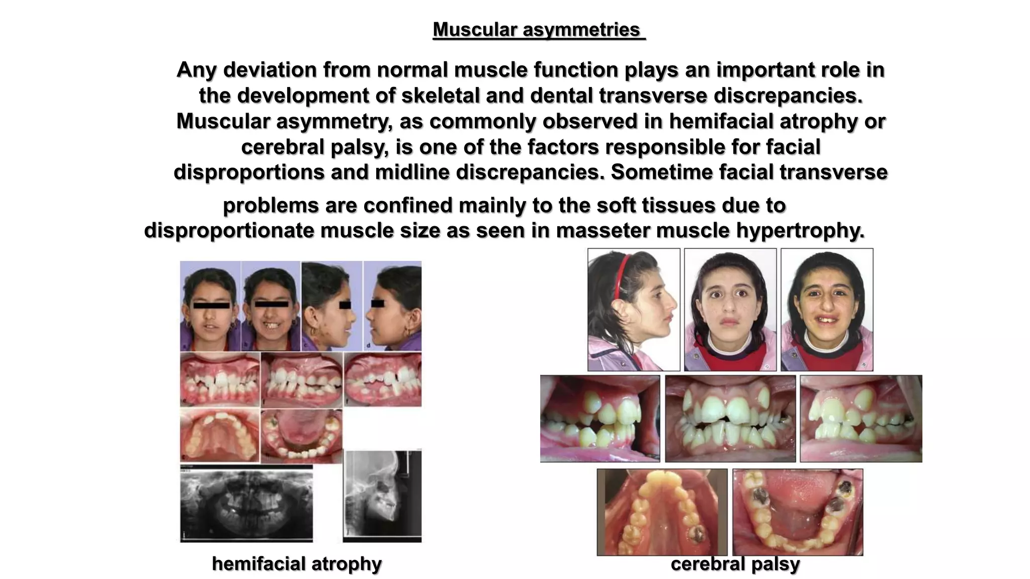Transverse discrepancies | PPTX