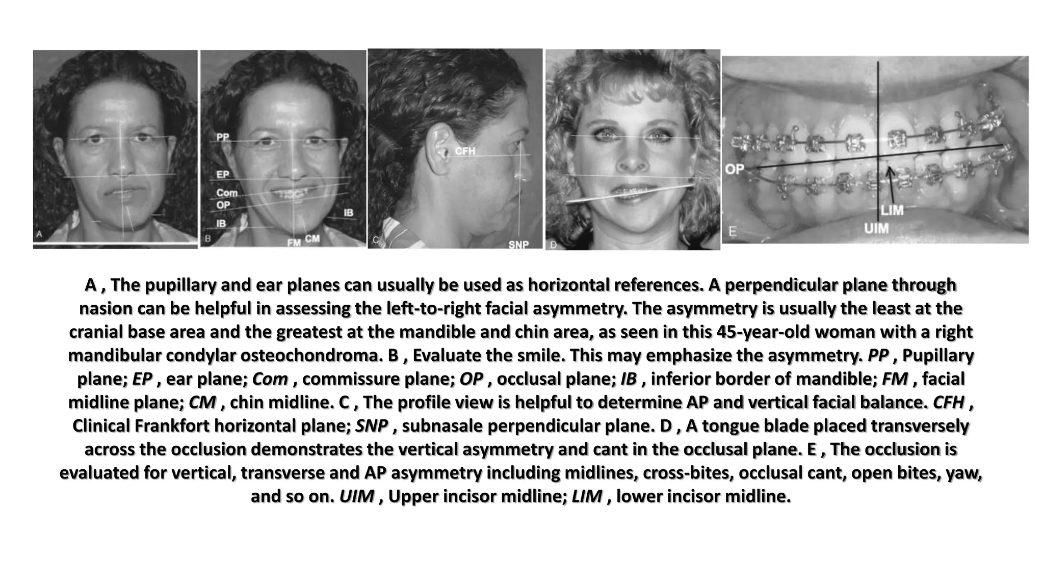 Transverse discrepancies | PPTX
