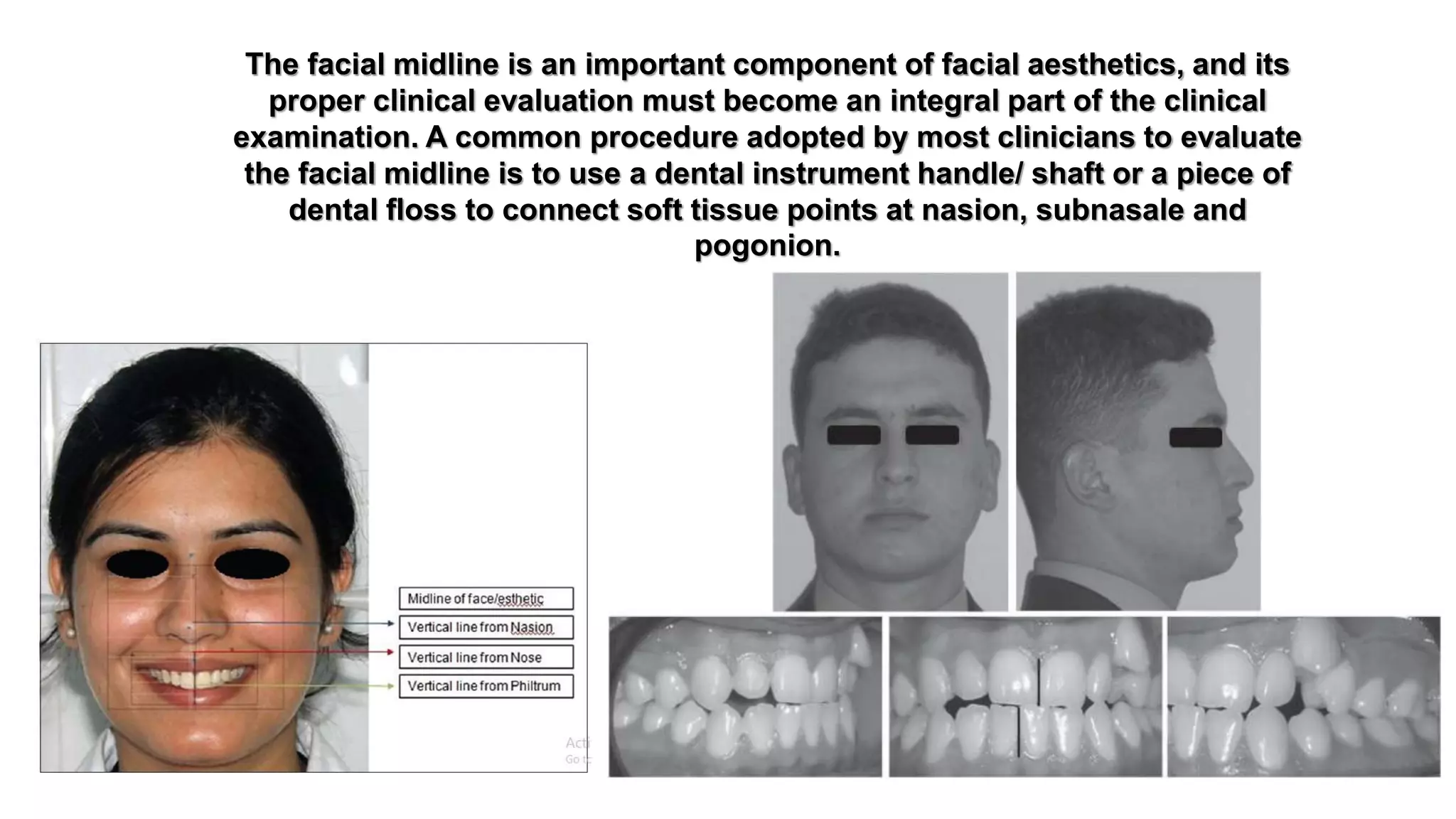 Transverse discrepancies | PPTX