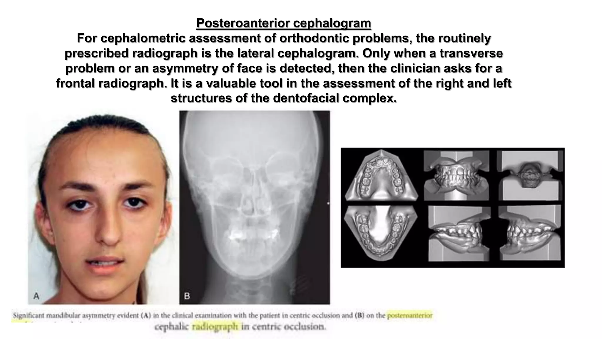 Transverse discrepancies | PPTX
