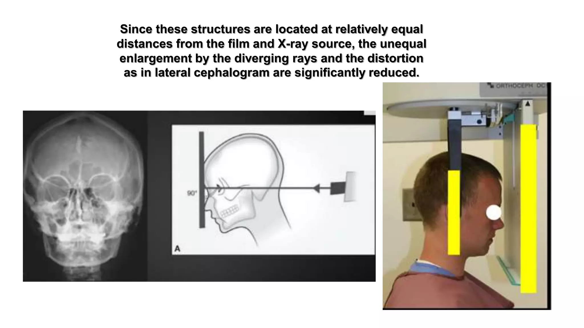 Transverse discrepancies | PPTX