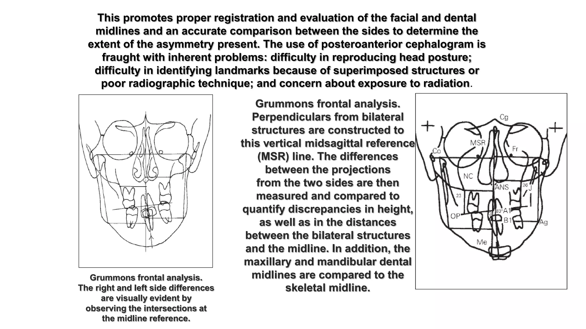 Transverse discrepancies | PPTX