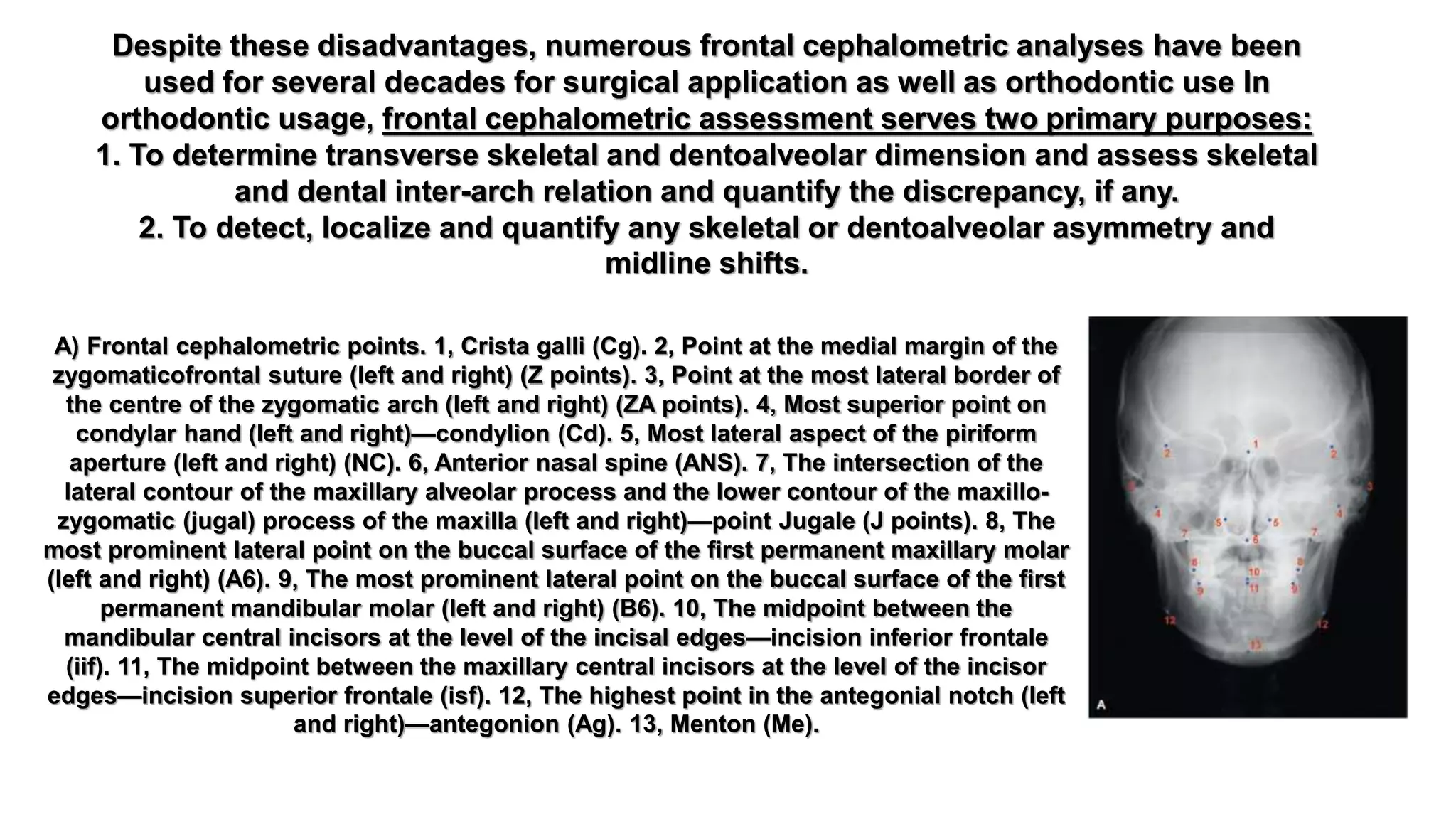 Transverse discrepancies | PPTX