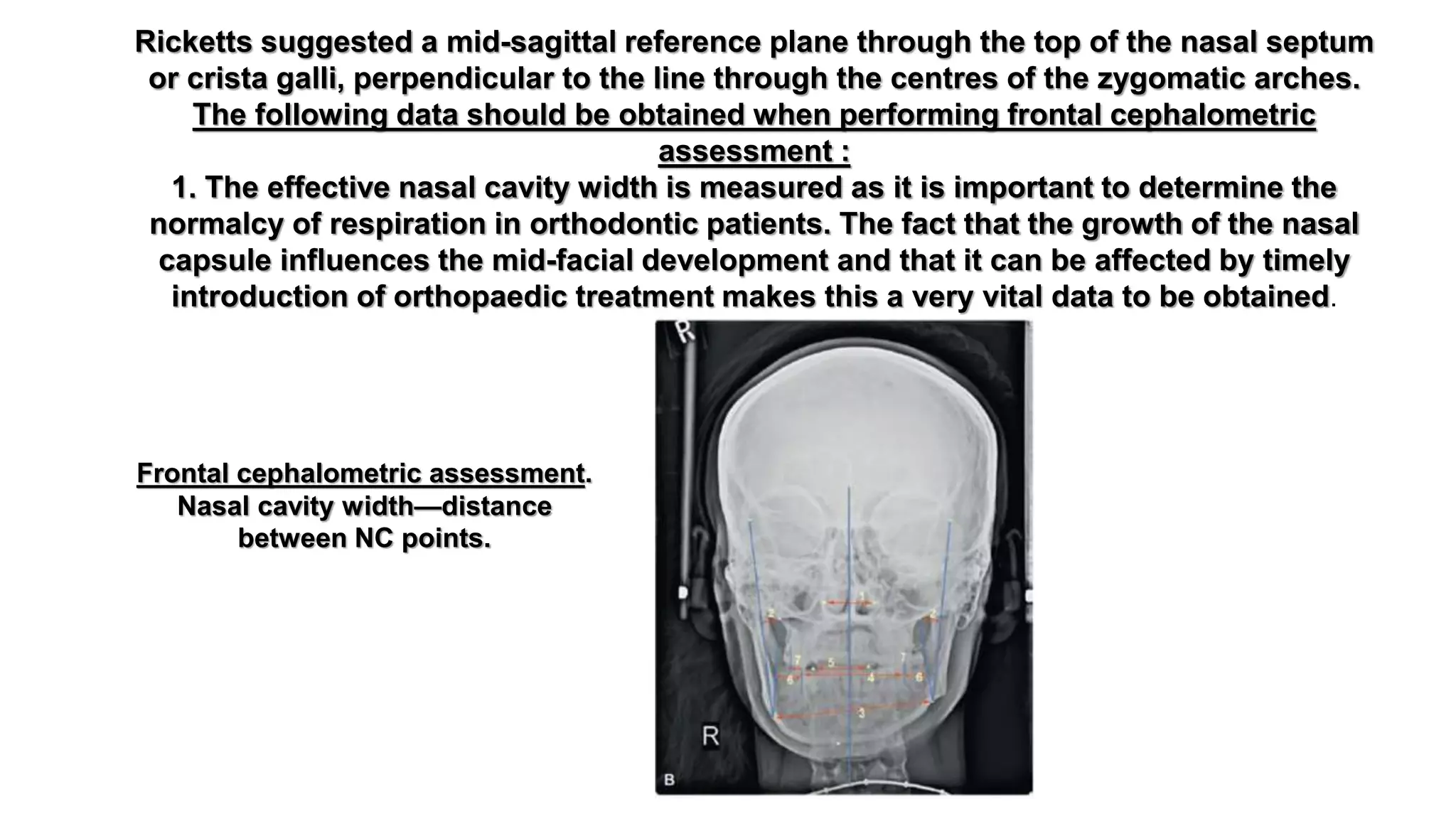 Transverse discrepancies | PPTX