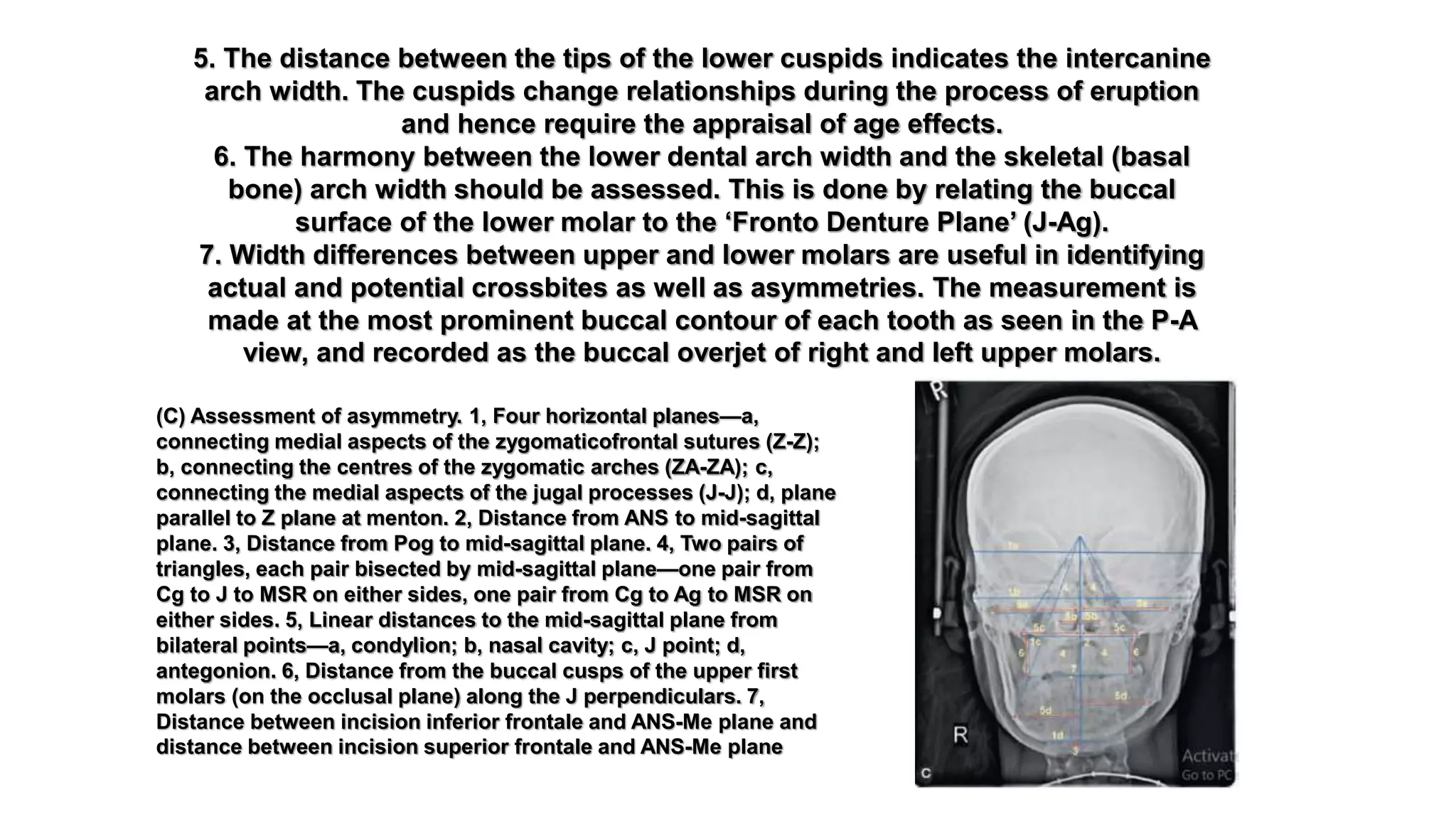 Transverse discrepancies | PPTX
