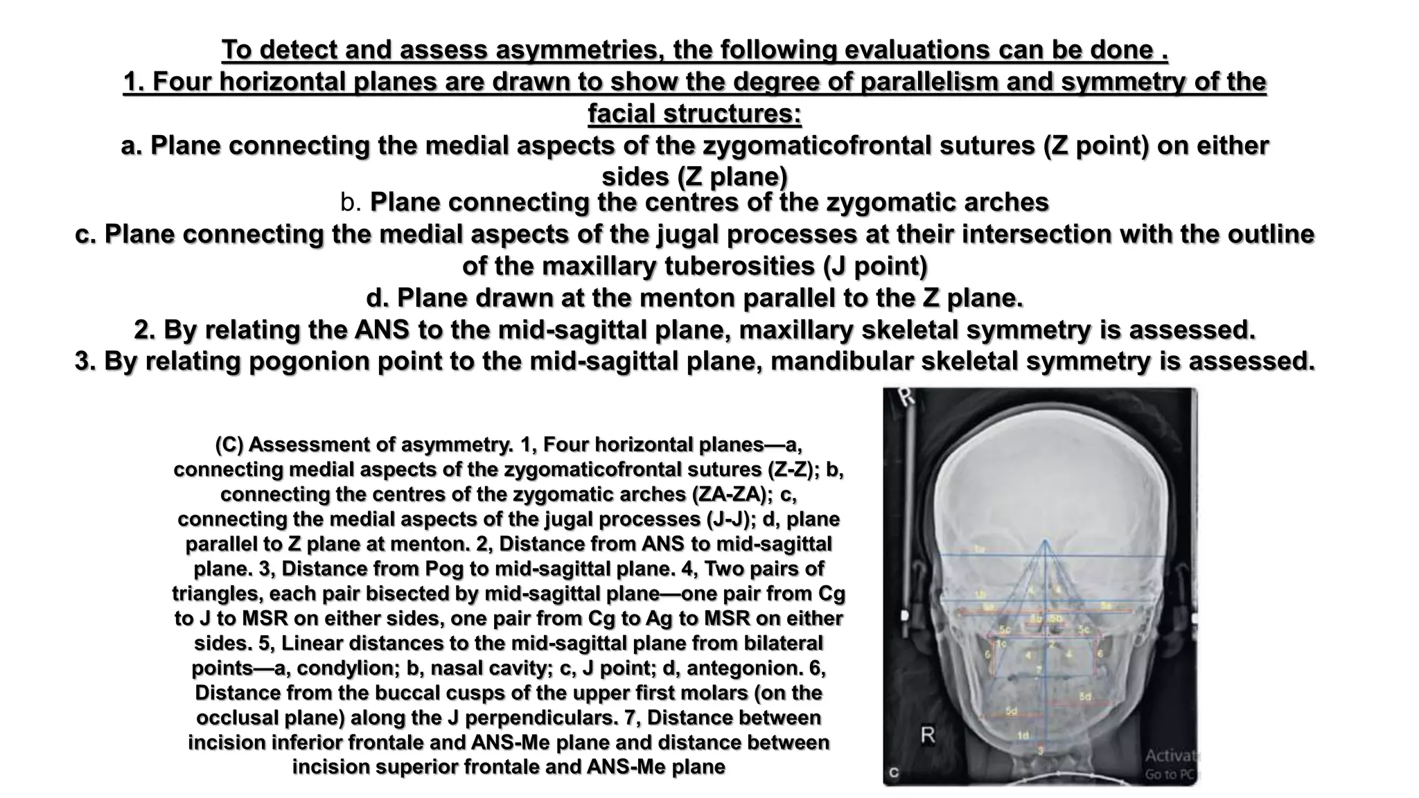 Transverse discrepancies | PPTX