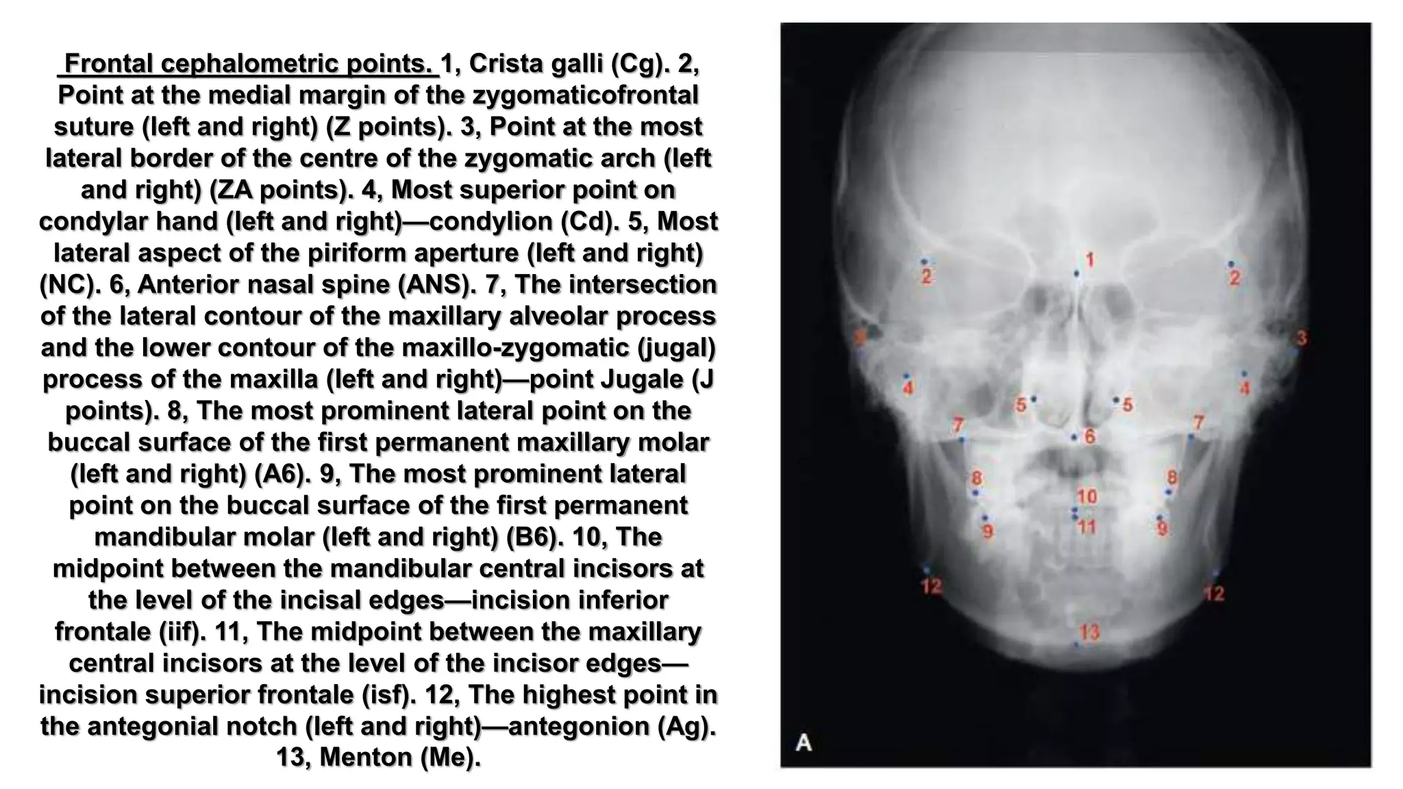 Transverse discrepancies | PPTX