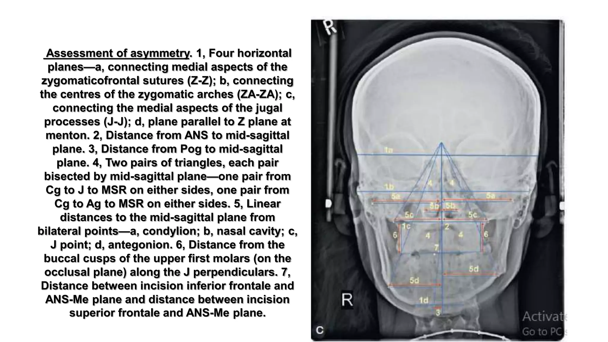 Transverse discrepancies | PPTX