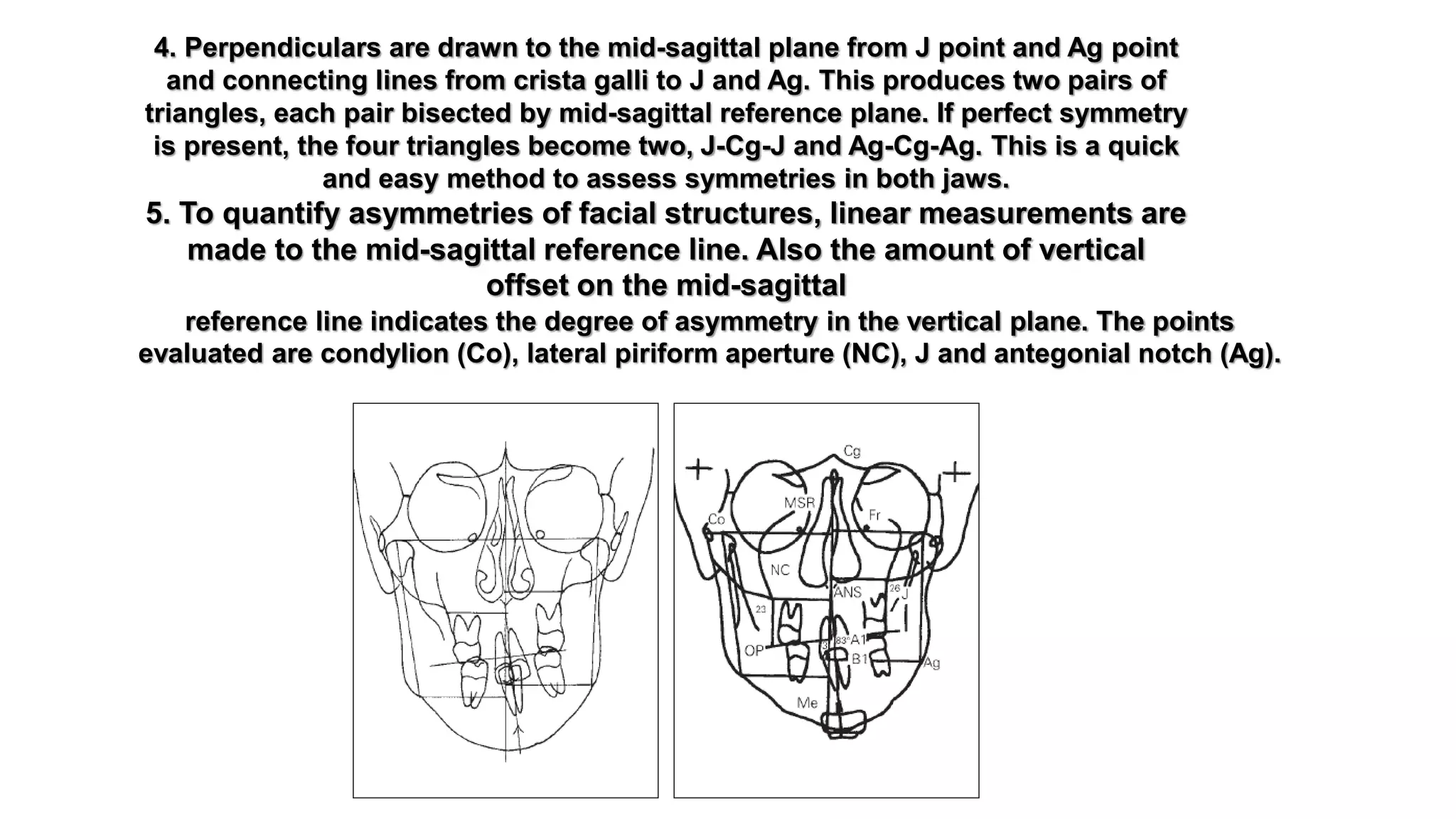 Transverse discrepancies | PPTX