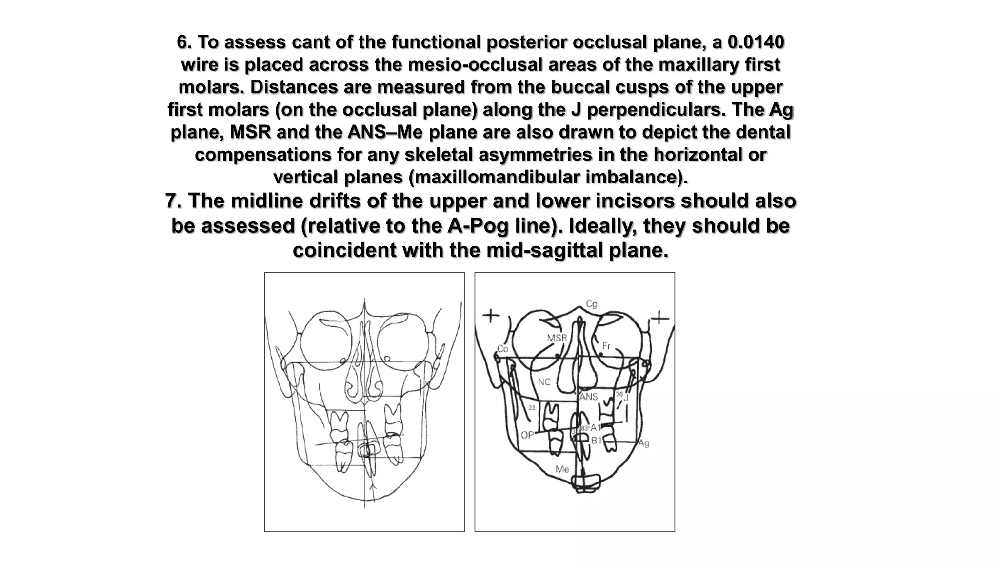 Transverse discrepancies | PPTX