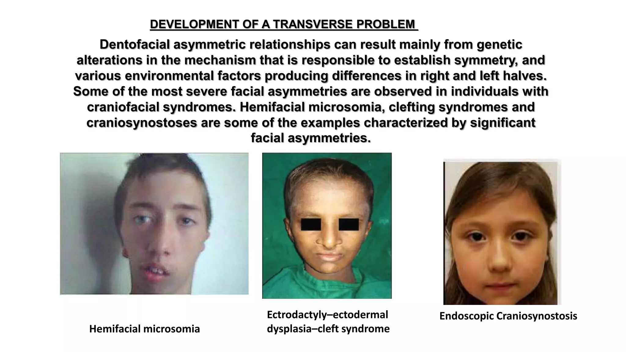 Transverse discrepancies | PPTX