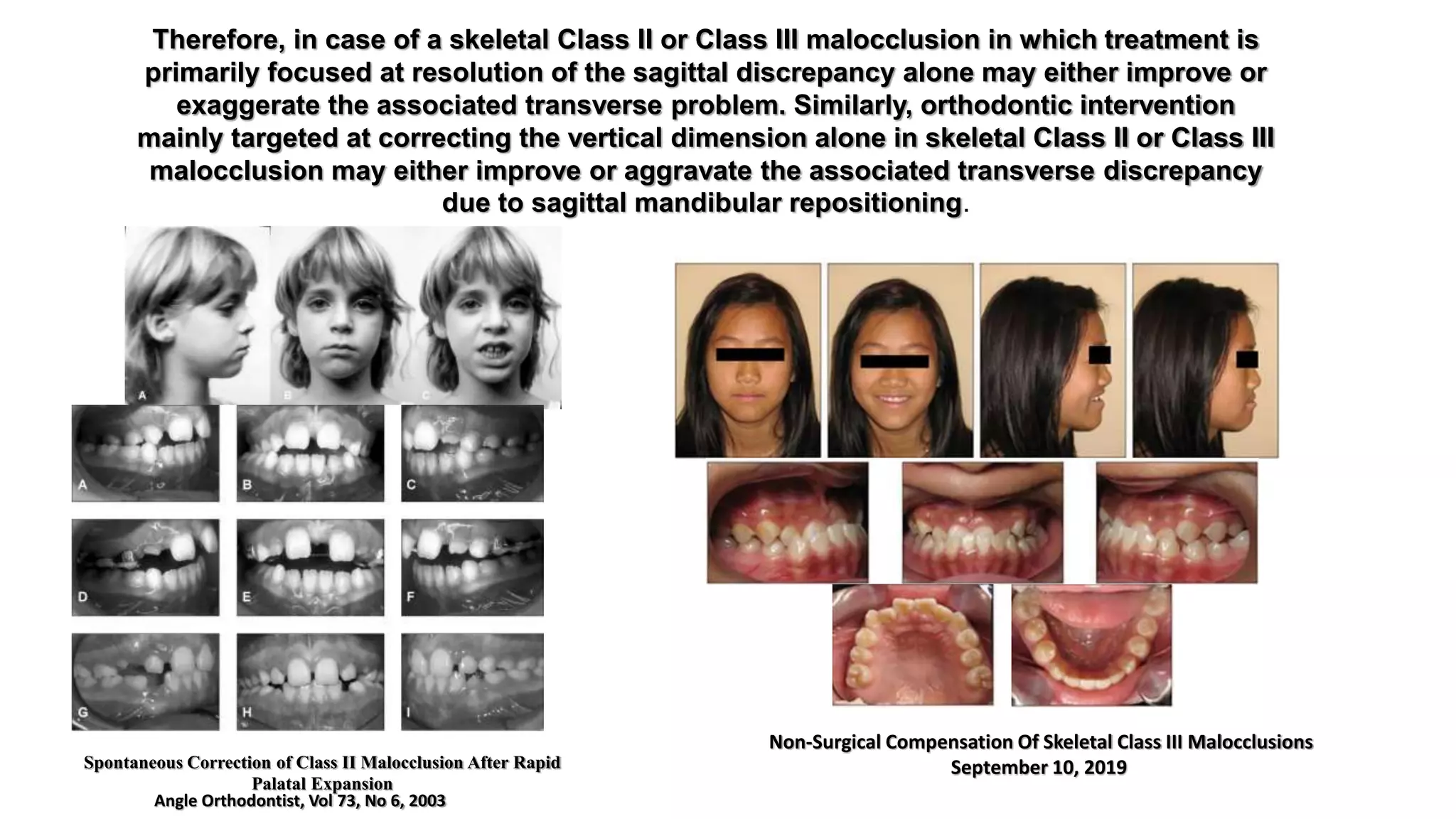 Transverse discrepancies | PPTX