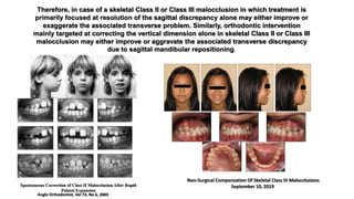 Transverse discrepancies | PPTX
