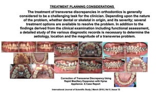 Transverse discrepancies | PPTX