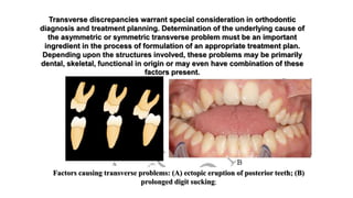 Transverse discrepancies | PPT