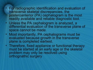 transverse discrepancy and its correction- M.M.Varadharaja.ppt