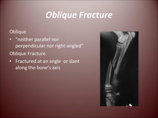 Transverse fracture presentation bio 120 | PPT