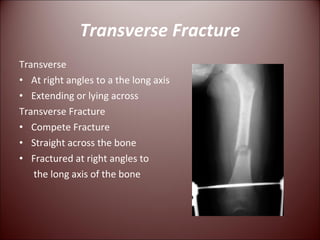 Transverse fracture presentation bio 120 | PPT