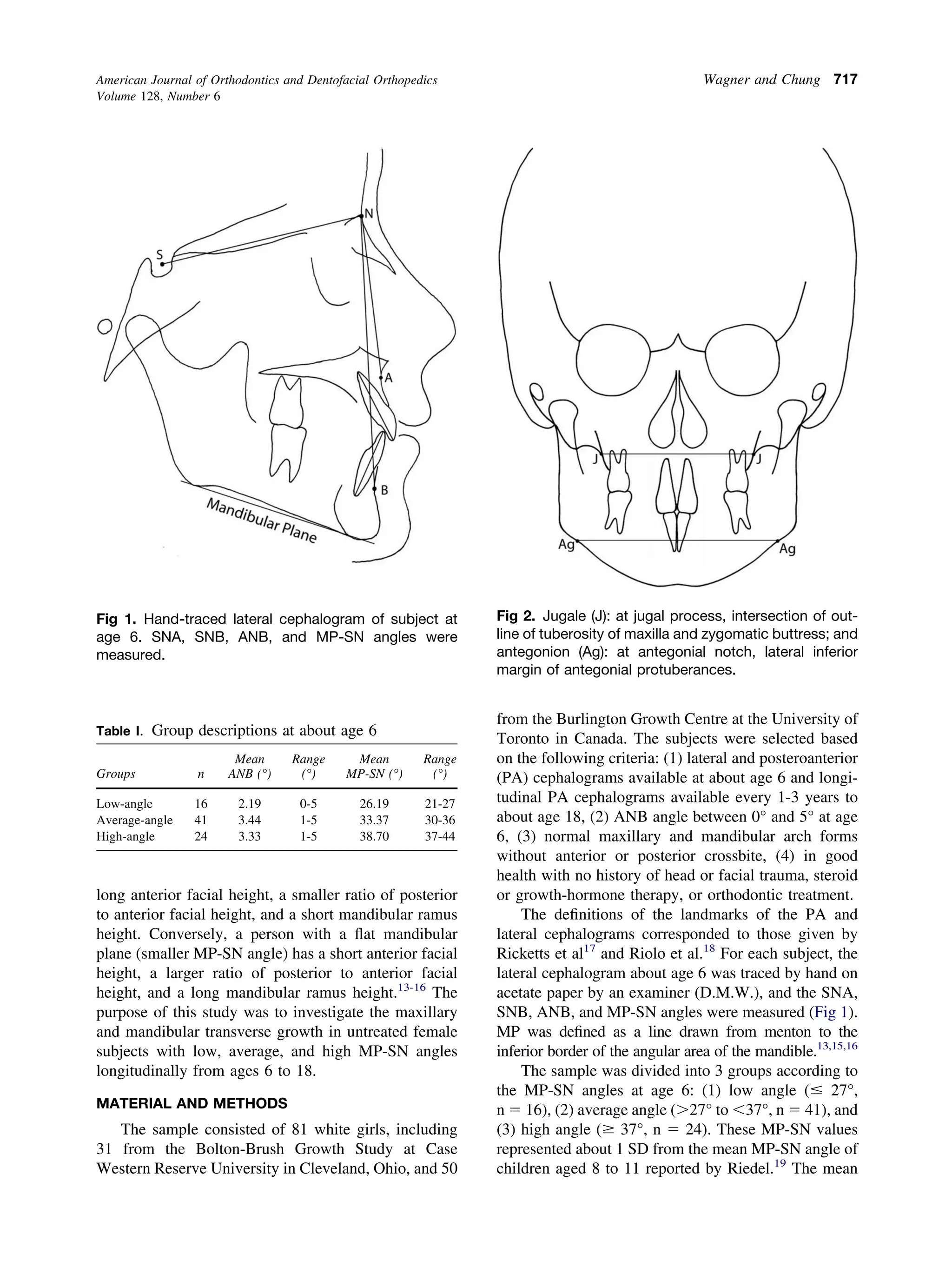 Transverse growth of the maxilla and mandible in untreated girls with ...