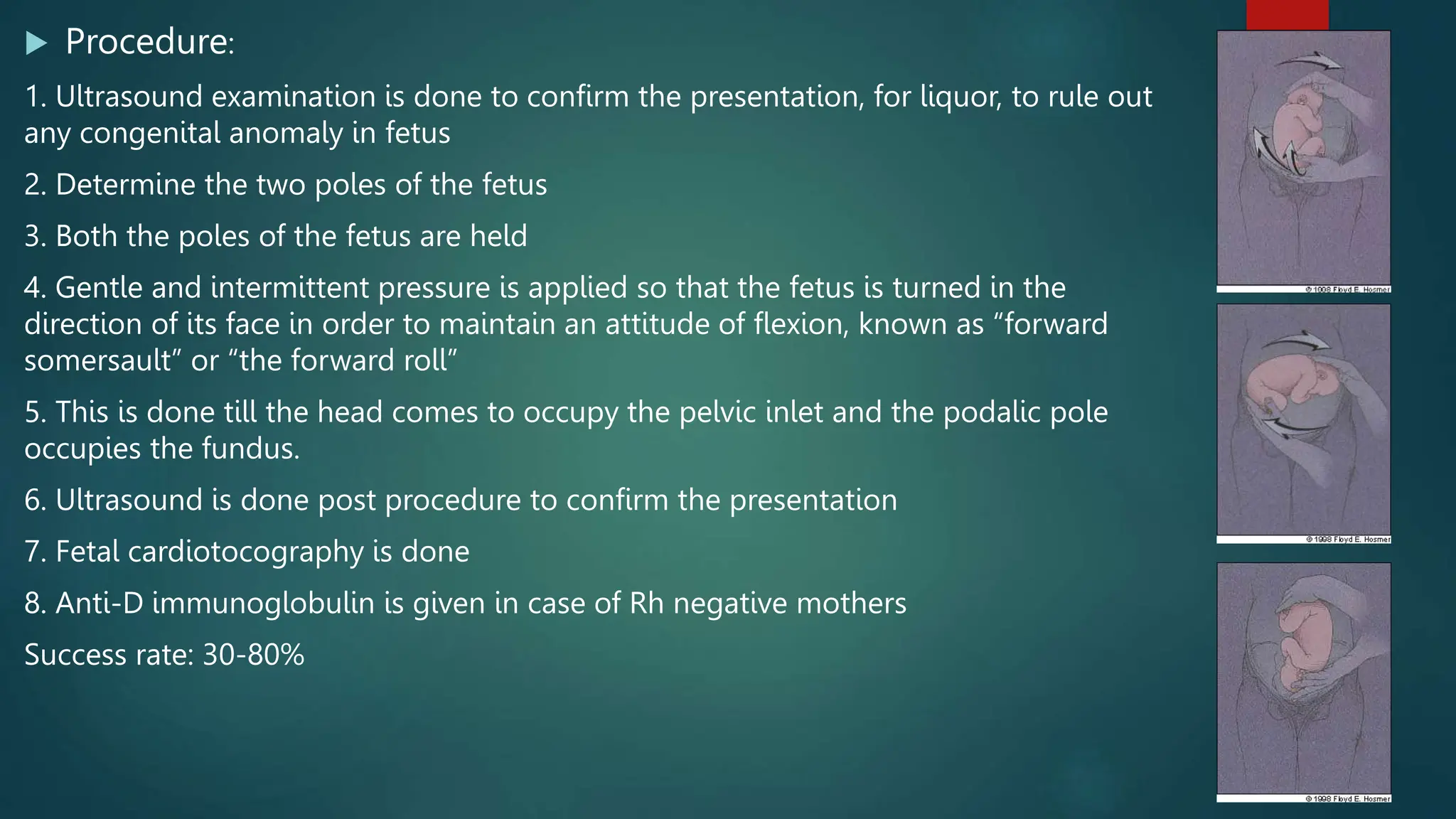 Management of pregnancies with transverse lie.pptx