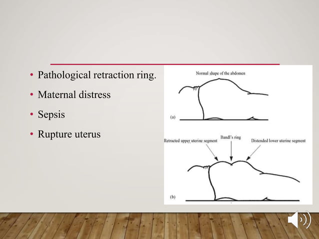 Transverse lie | PPTX | Pregnancy | Reproductive Health
