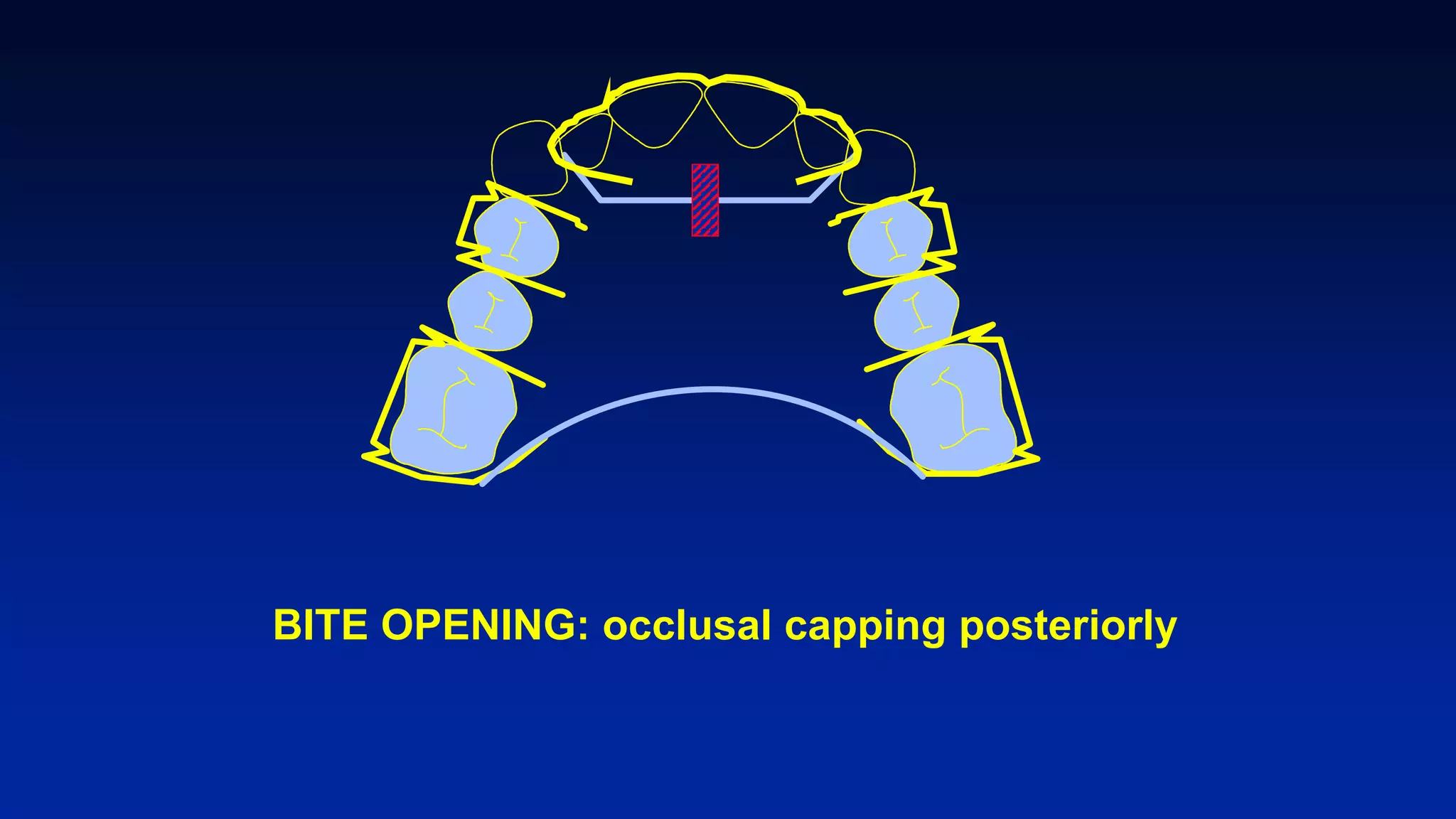 Transverse malocclusion (crossbite) | PPTX
