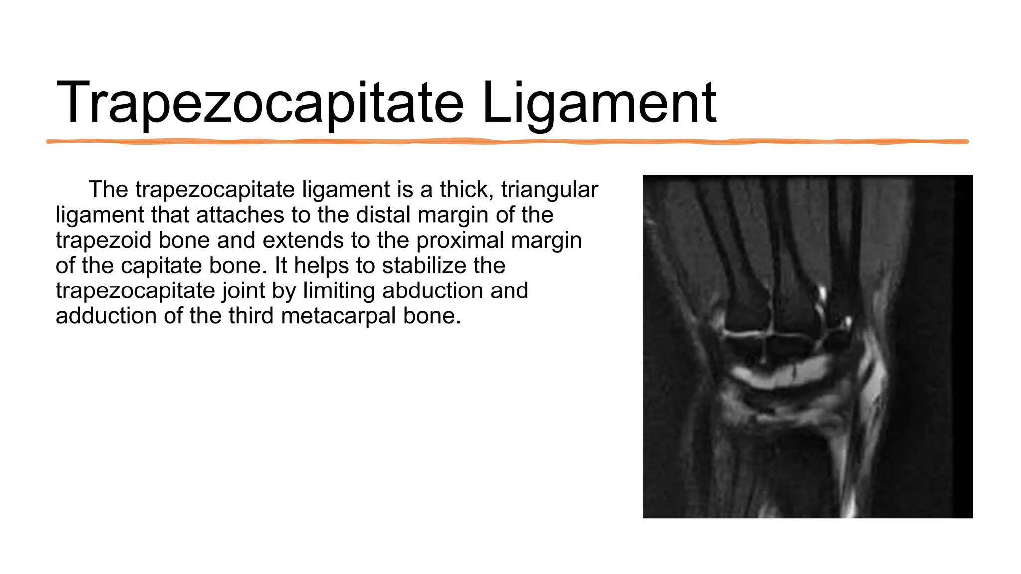 Anatomy of Trapezoid bone | PPTX