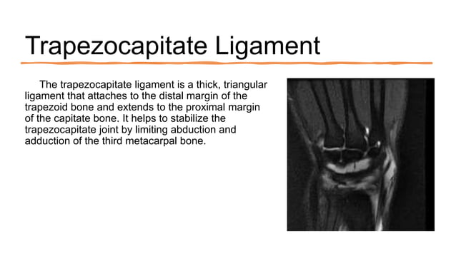 Anatomy of Trapezoid bone | PPTX