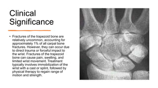 Anatomy of Trapezoid bone | PPTX