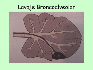 traqueobronquitis infecciosa canina .ppt