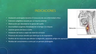 Traqueostomia,Cuidaos y recomendaciones | PPTX